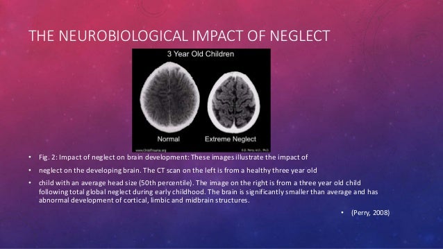 Fostering Connections: Responding to Attachment Disorders