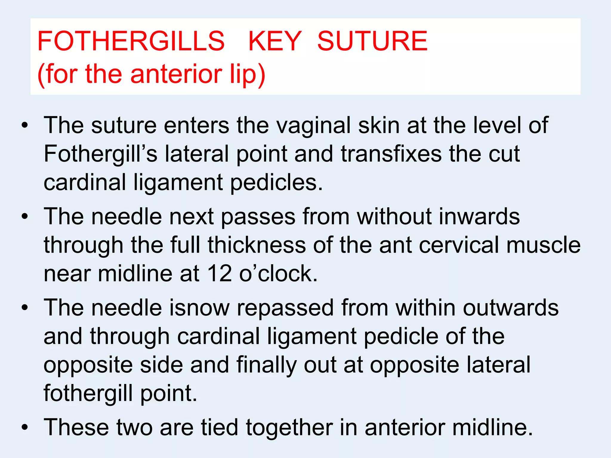 FOTHERGIL'S OPERATION | PPTX