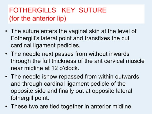 FOTHERGIL'S OPERATION | PPTX