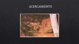 Fotografía forense | PPTX
