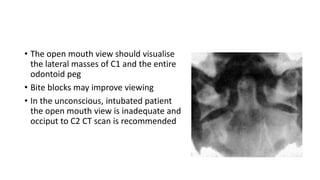 Foto polos cervical - Irfani Ryan.pptx