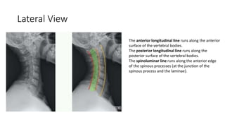 Foto polos cervical - Irfani Ryan.pptx