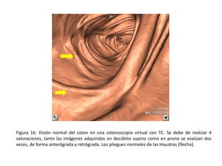 fotos_con_ilustraciones_colon.ppt