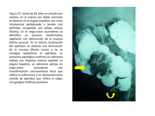 fotos_con_ilustraciones_colon.ppt