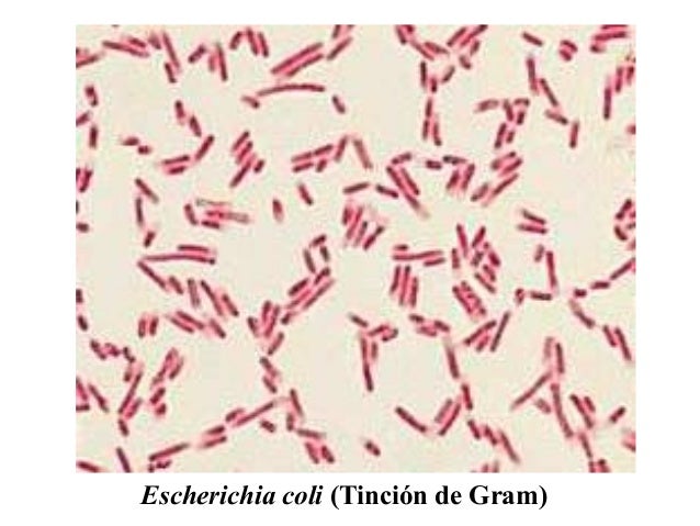 Fotos de enterobacterias