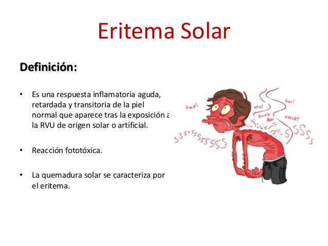 Fotosensibilidad y fotoenvejecimiento (dermatoheliosis)
