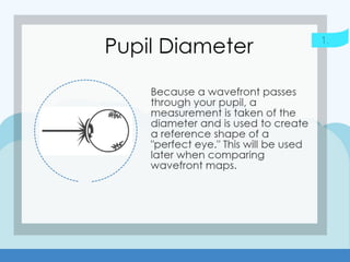 Wavefront LASIK: The Process | PDF