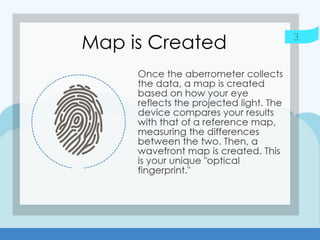 Wavefront LASIK: The Process | PDF