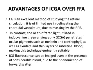 Foundus fluoresecein angiography and indocyanine angiography (2) | PPTX ...