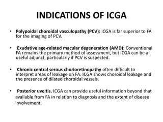 Foundus fluoresecein angiography and indocyanine angiography (2) | PPT