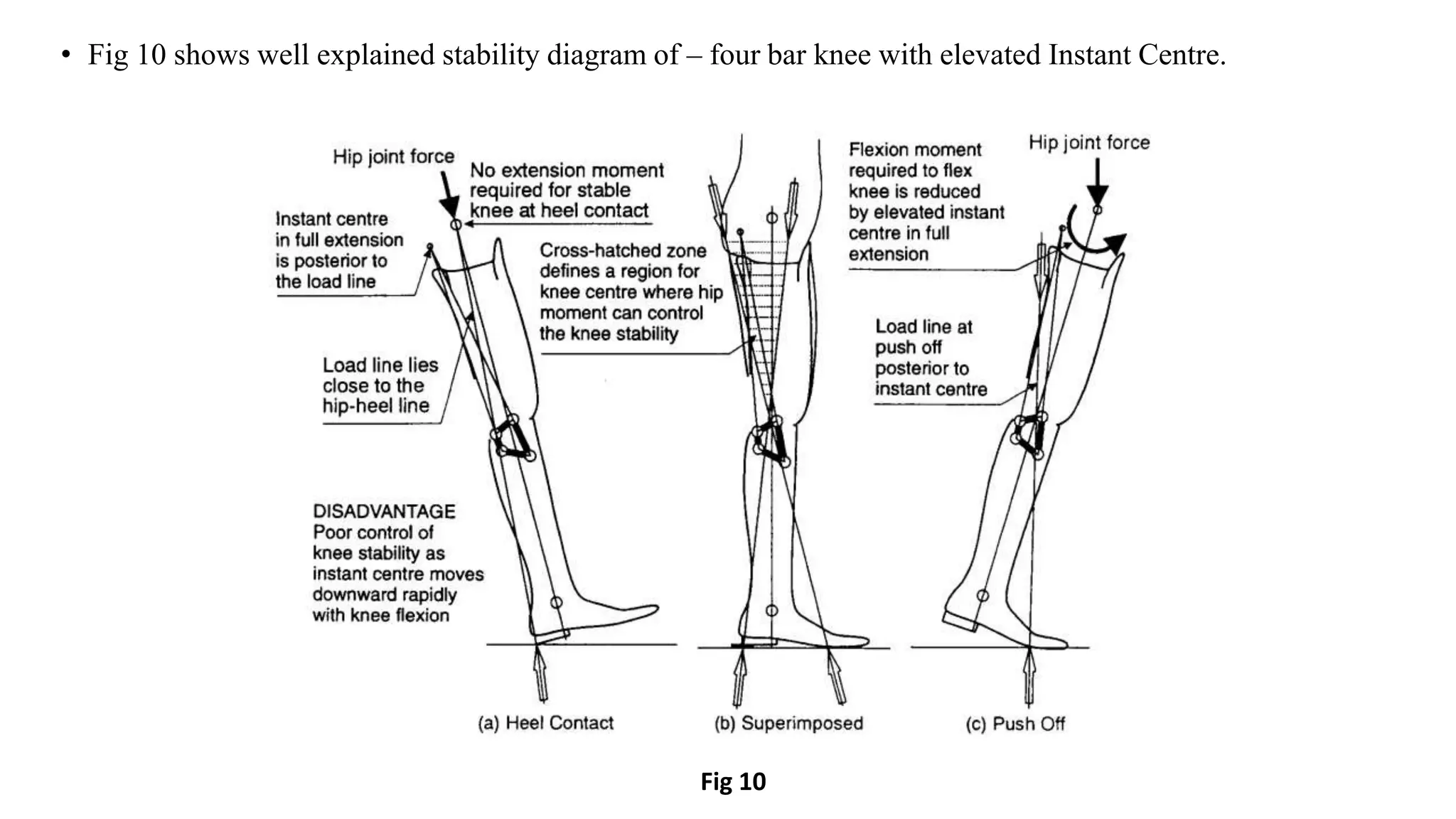 BIOMECHANICS OF FOUR-BAR LINKAGE PROSTHETIC KNEE MECHANISM | PPTX
