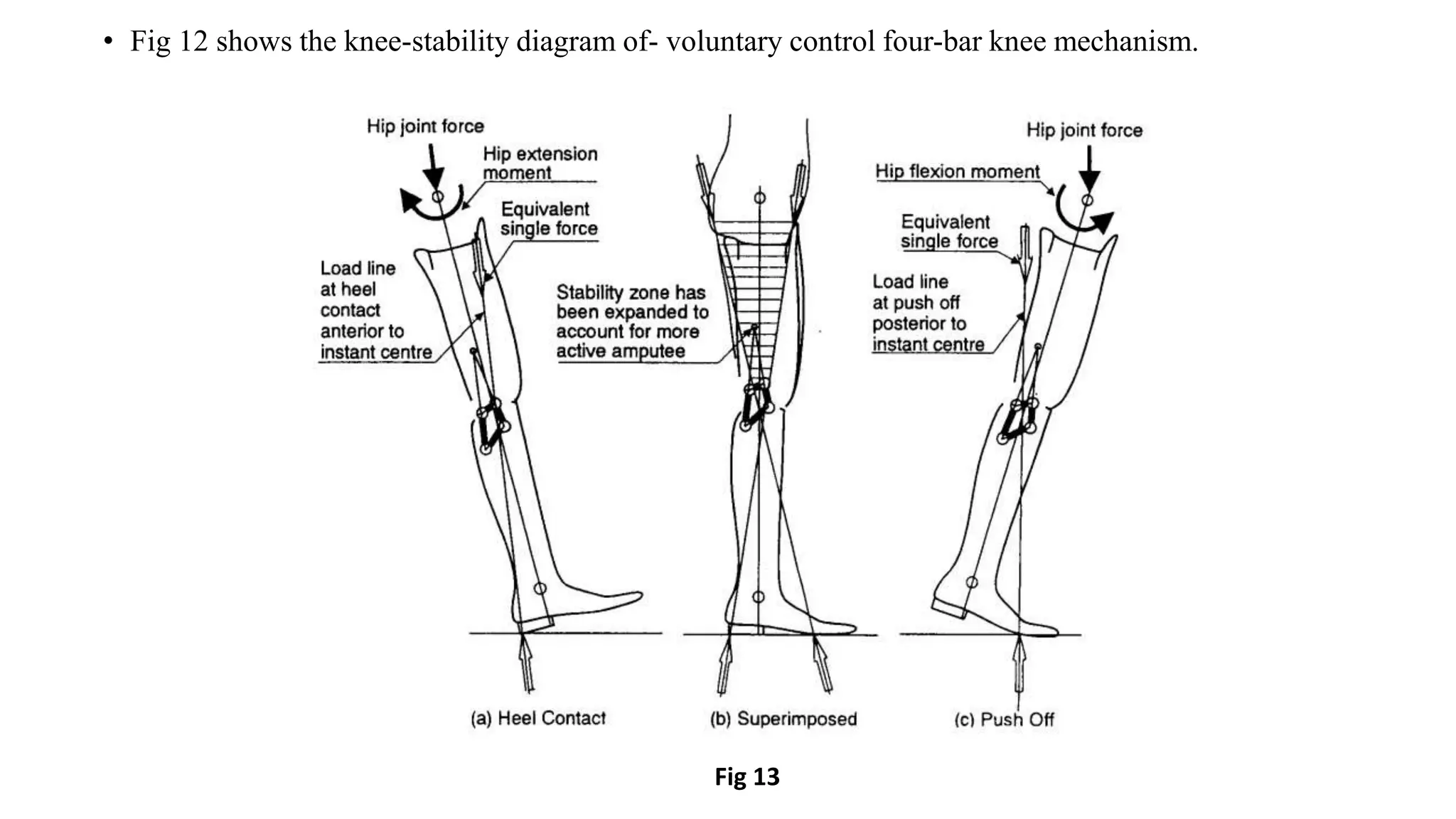 BIOMECHANICS OF FOUR-BAR LINKAGE PROSTHETIC KNEE MECHANISM | PPTX