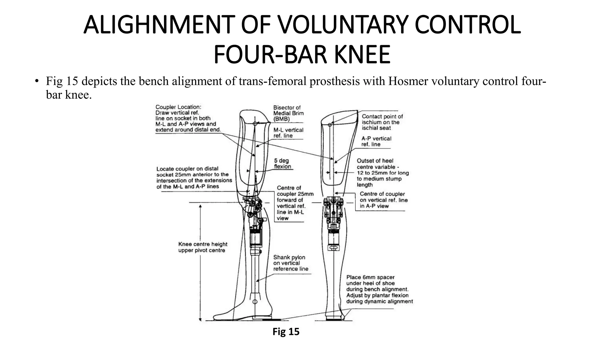 BIOMECHANICS OF FOUR-BAR LINKAGE PROSTHETIC KNEE MECHANISM | PPTX