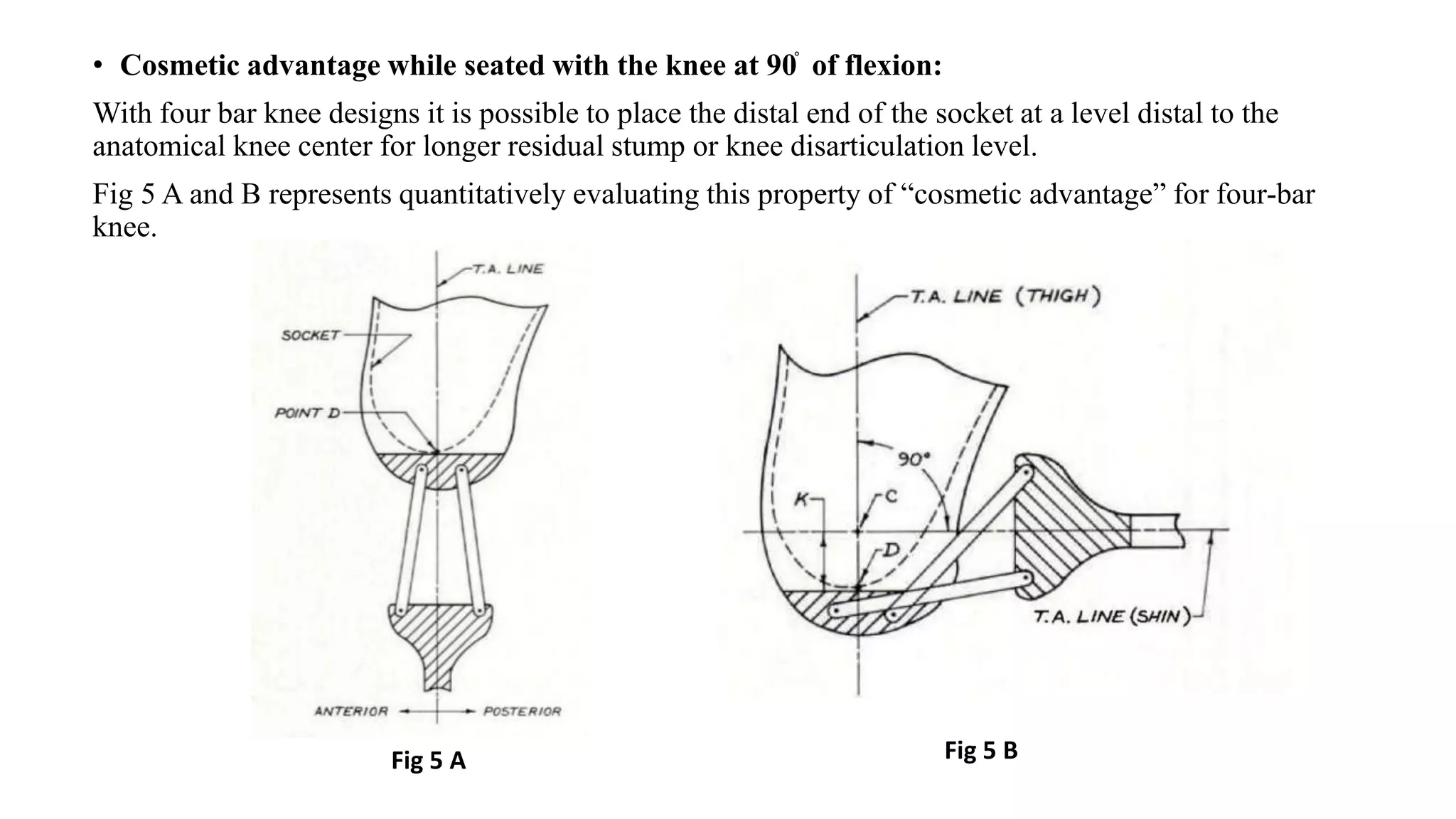 BIOMECHANICS OF FOUR-BAR LINKAGE PROSTHETIC KNEE MECHANISM | PPTX