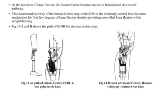 BIOMECHANICS OF FOUR-BAR LINKAGE PROSTHETIC KNEE MECHANISM | PPTX