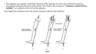 BIOMECHANICS OF FOUR-BAR LINKAGE PROSTHETIC KNEE MECHANISM | PPTX