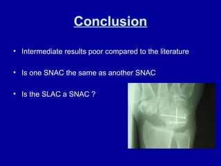 Four corner arthrodesis a retrospective review | PPT