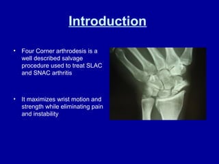 Four corner arthrodesis a retrospective review | PPT