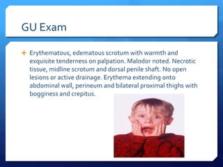 Fournier's gangrene | PPTX