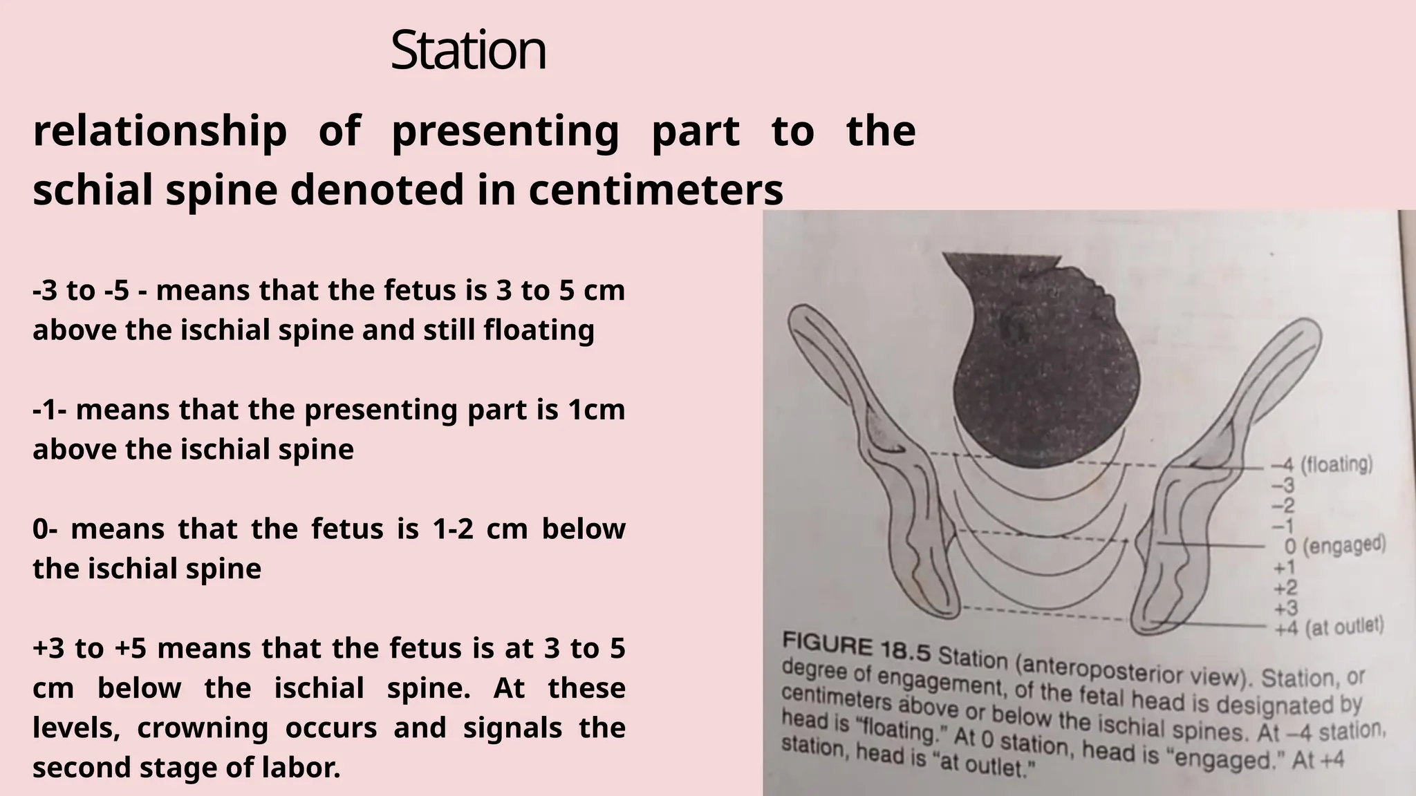 Four stages of labor_20241122_090702_0000.pptx