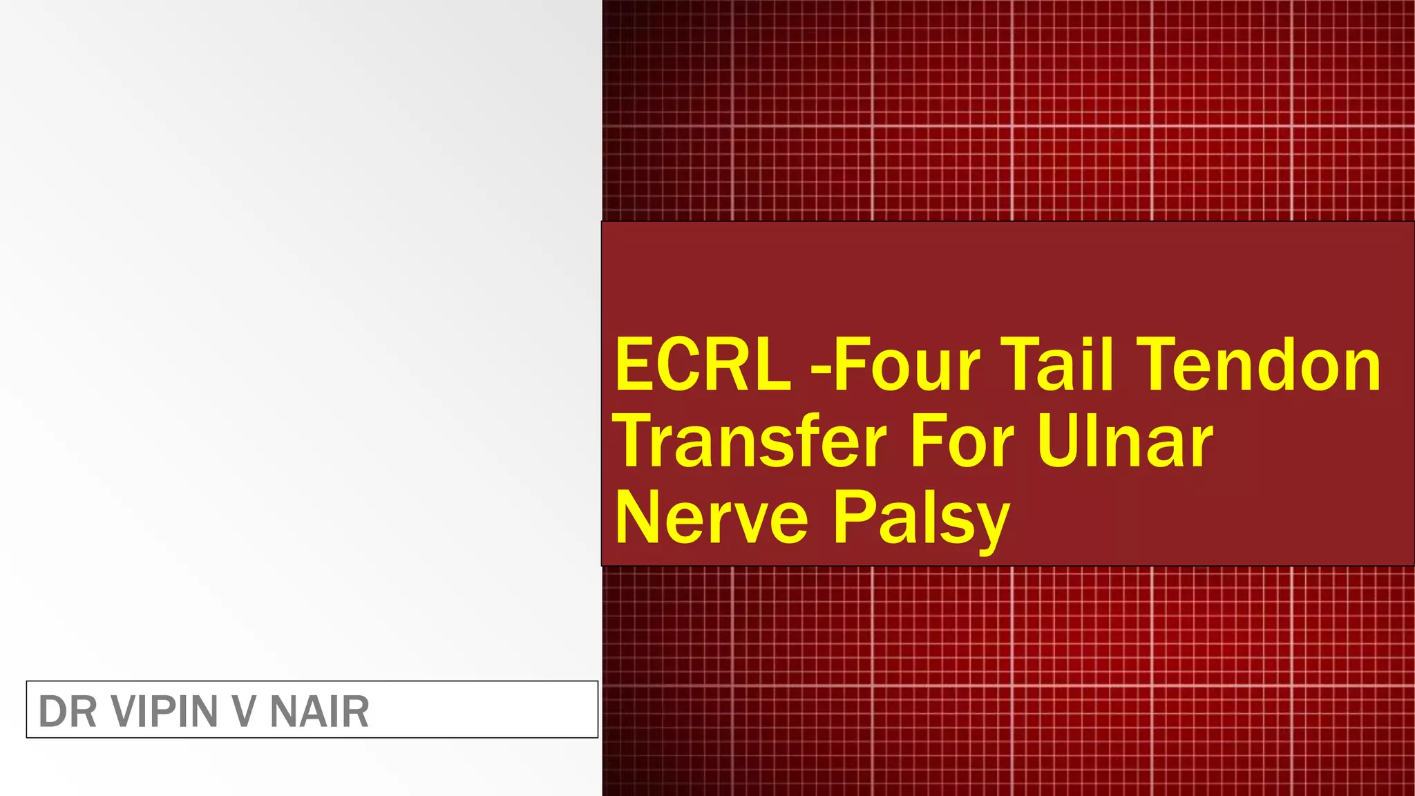 ECRL Four tail tendon transfer DR VIPIN V NAIR | PPTX