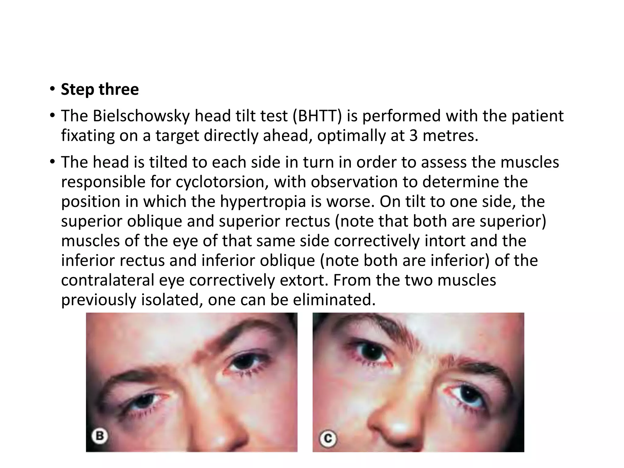 Anatomy of Fourth and sixth cranial nerve | PPTX