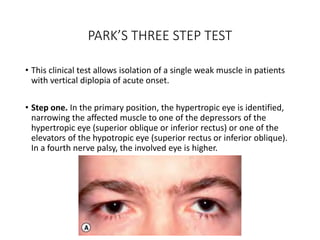 Anatomy of Fourth and sixth cranial nerve | PPTX