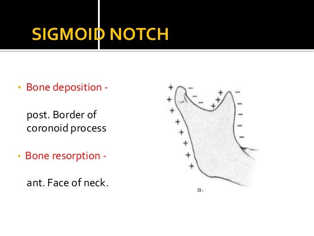 Fourth seminar mandible