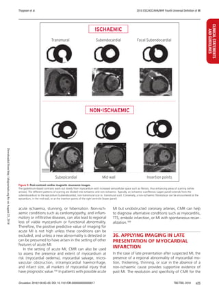 Fourth universal definition of myocardial | PDF