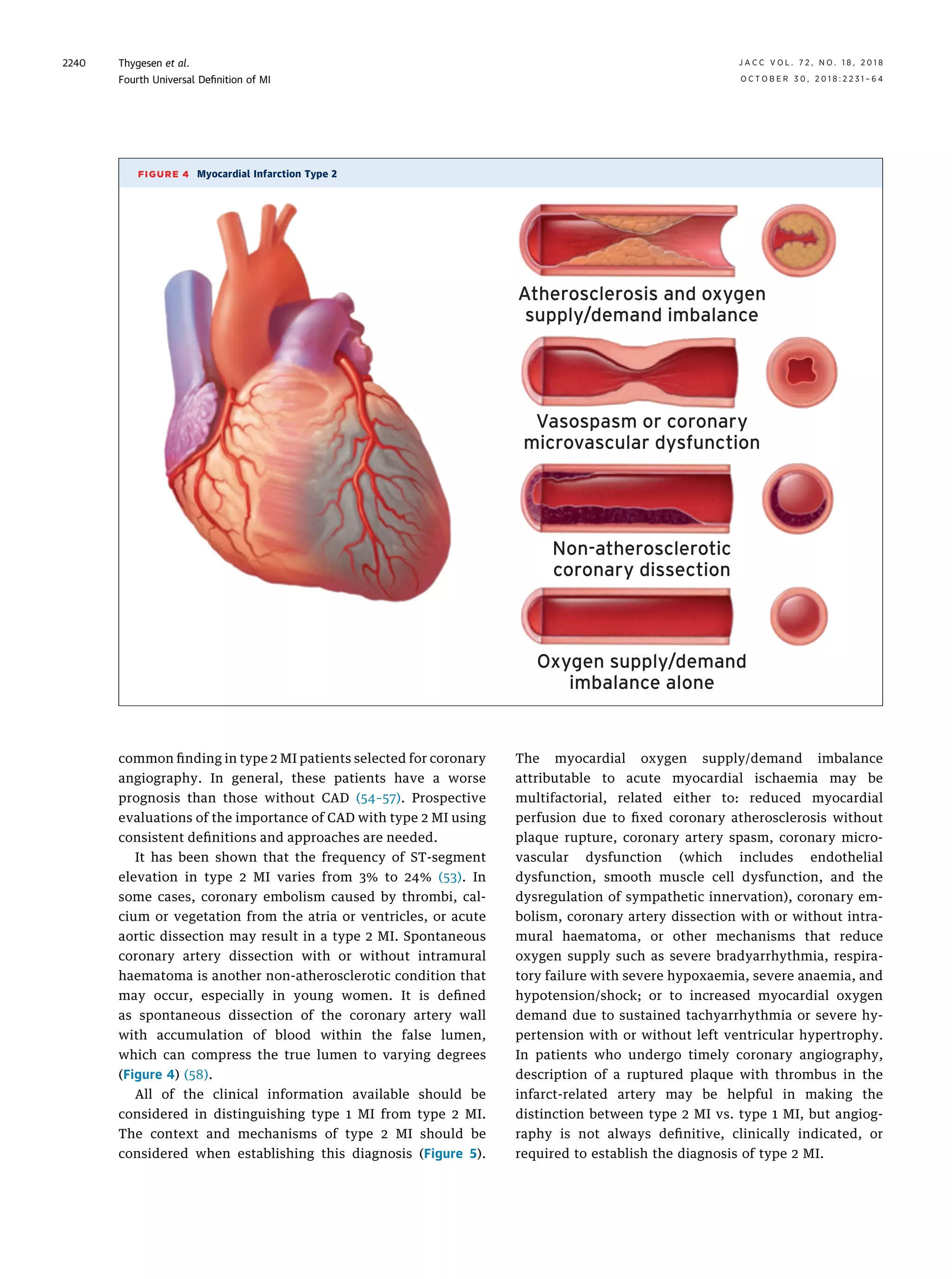 Fourth universal definition of myocardial infarction 2018 | PDF | Heart ...