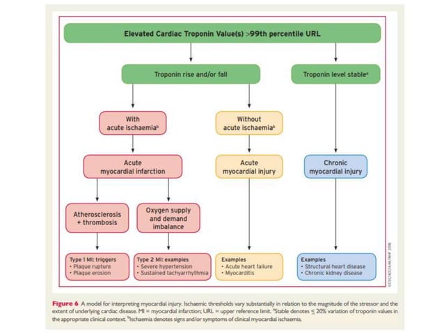 Fourth universal definition of myocardial infarction (2018) | PPTX