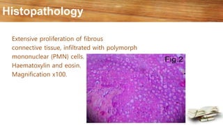 Fowl pox | PPTX