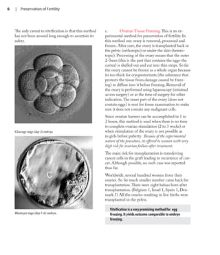 Fertility Preservation; an e-Guide | PDF