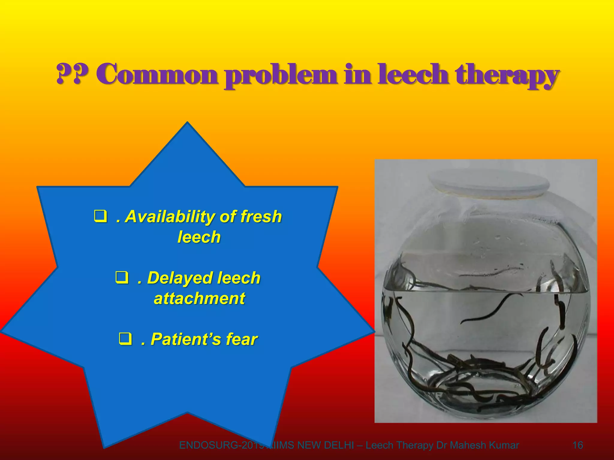Leech and Leech therapy :scientific overview and its application | PDF