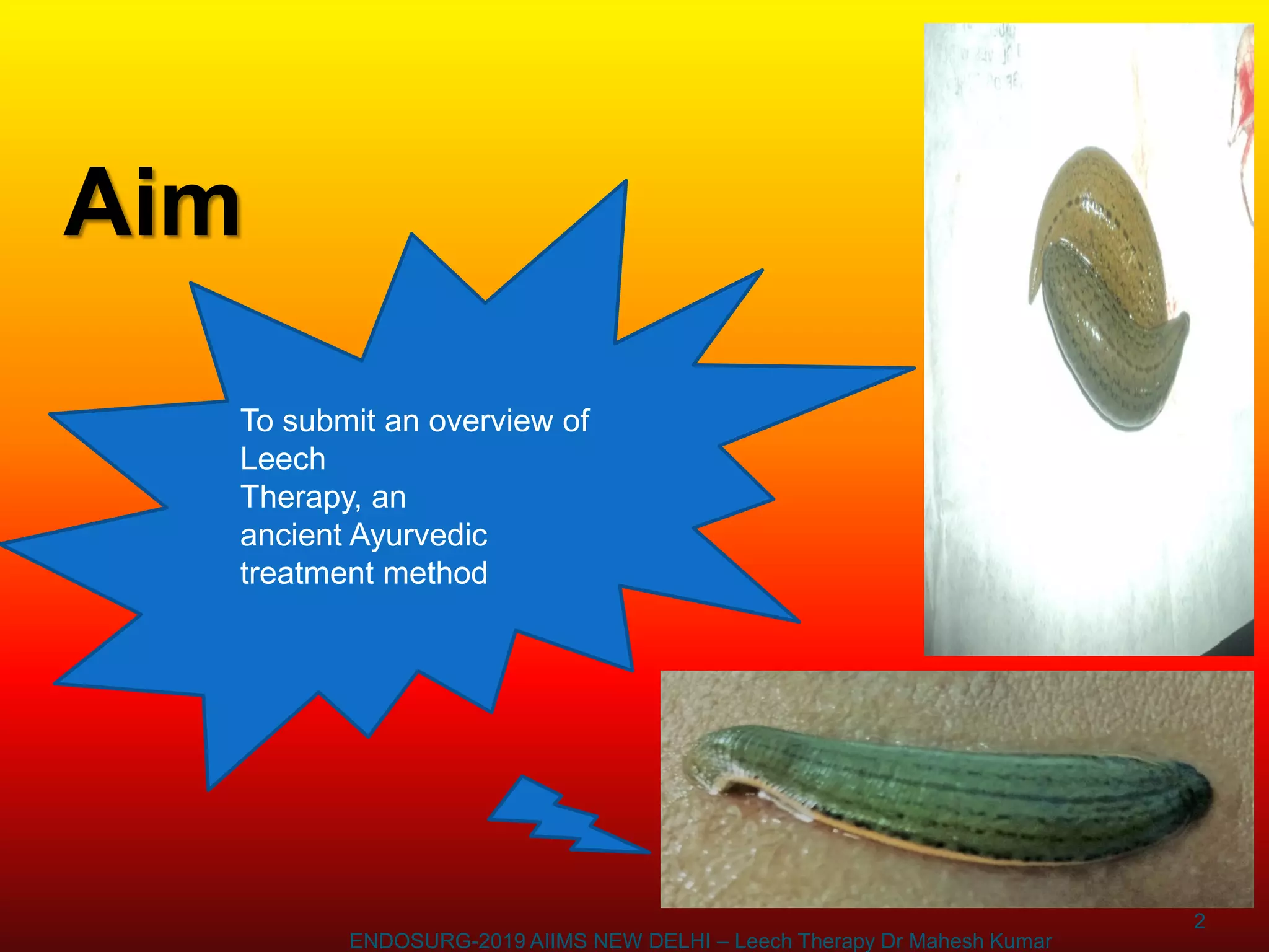 Leech and Leech therapy :scientific overview and its application | PDF