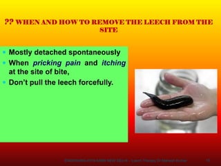 Leech and Leech therapy :scientific overview and its application | PPT