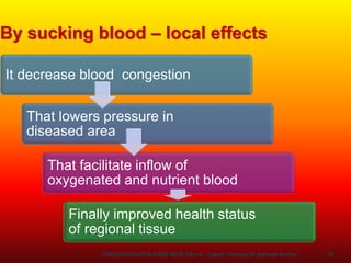 Leech and Leech therapy :scientific overview and its application | PPT