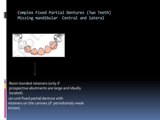 Fpd design by dr vikram | PPTX