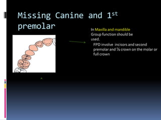 Fpd design by dr vikram | PPTX