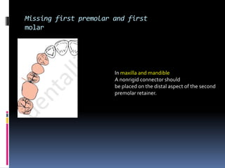 Fpd design by dr vikram | PPTX