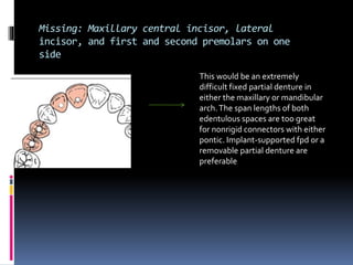 Fpd design by dr vikram | PPTX