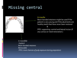 Fpd design by dr vikram | PPTX