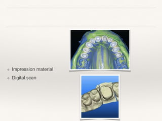 Fpd impression | PPTX