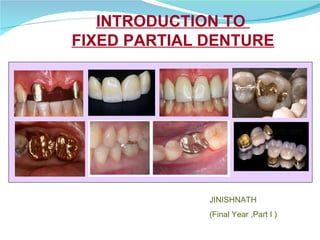 Introduction to fixed partial denture | PPT