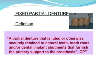 Introduction to fixed partial denture | PPT