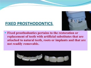 Introduction to fixed partial denture | PPT