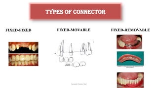 Introduction to Fixed Partial Denture... | PPTX