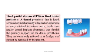 Introduction to Fixed Partial Denture... | PPTX