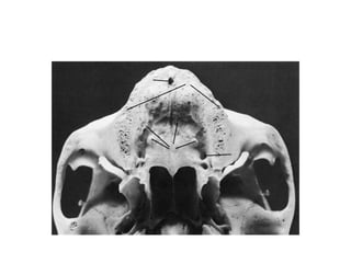 Fpd,rpd and implant | PPTX