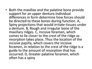 Fpd,rpd and implant | PPTX